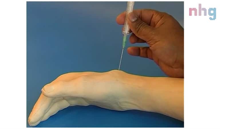 Instructiefilm Punctie ganglion - NHG